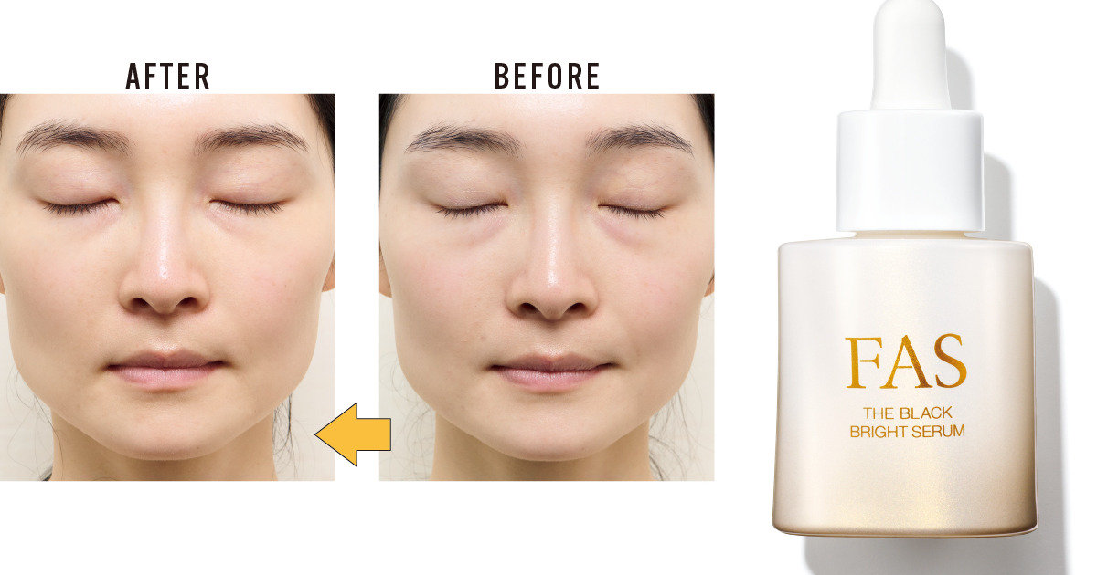 受賞ブライトニングコスメをお試し。FASの美容液で、シミステージがここまで改善！ | マキアオンライン(MAQUIA ONLINE)